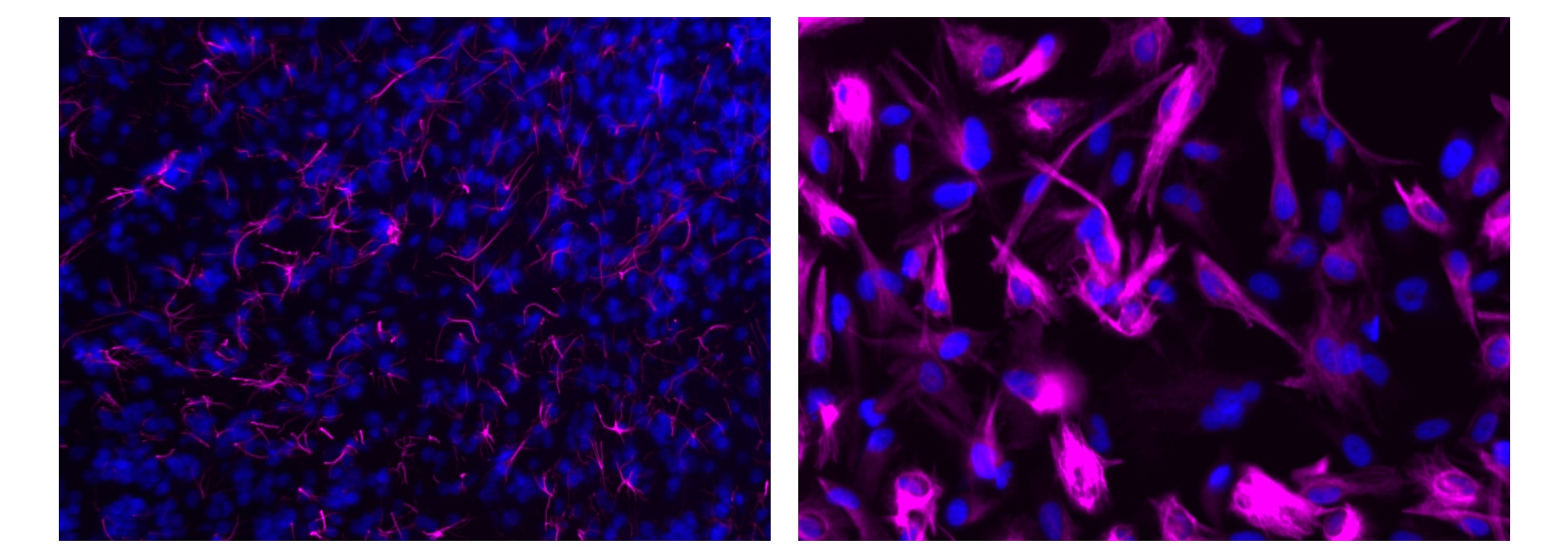 Alexa Fluor® 647 Mouse anti-GFAP