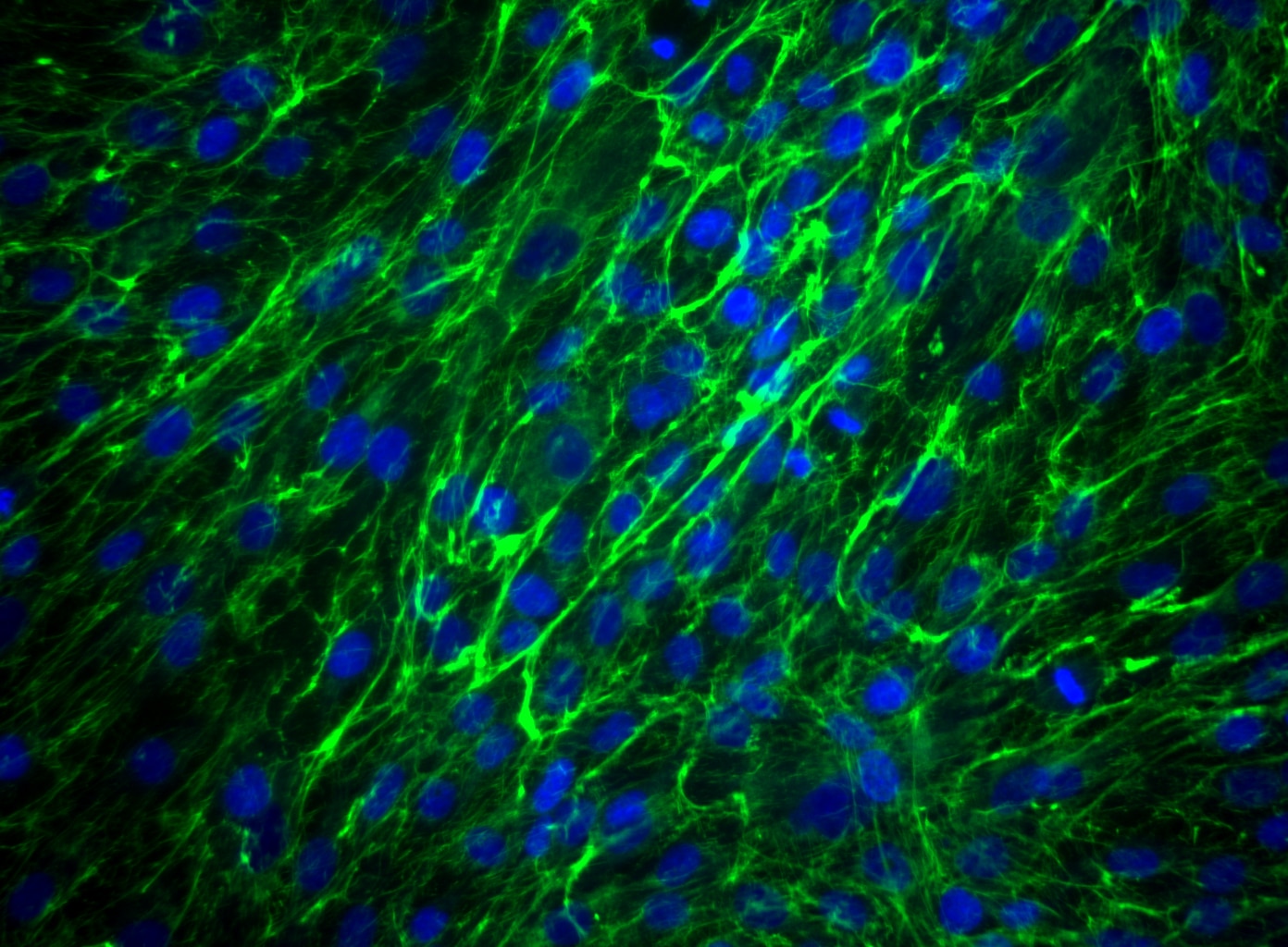 Alexa Fluor® 488 Mouse Anti-Fibronectin