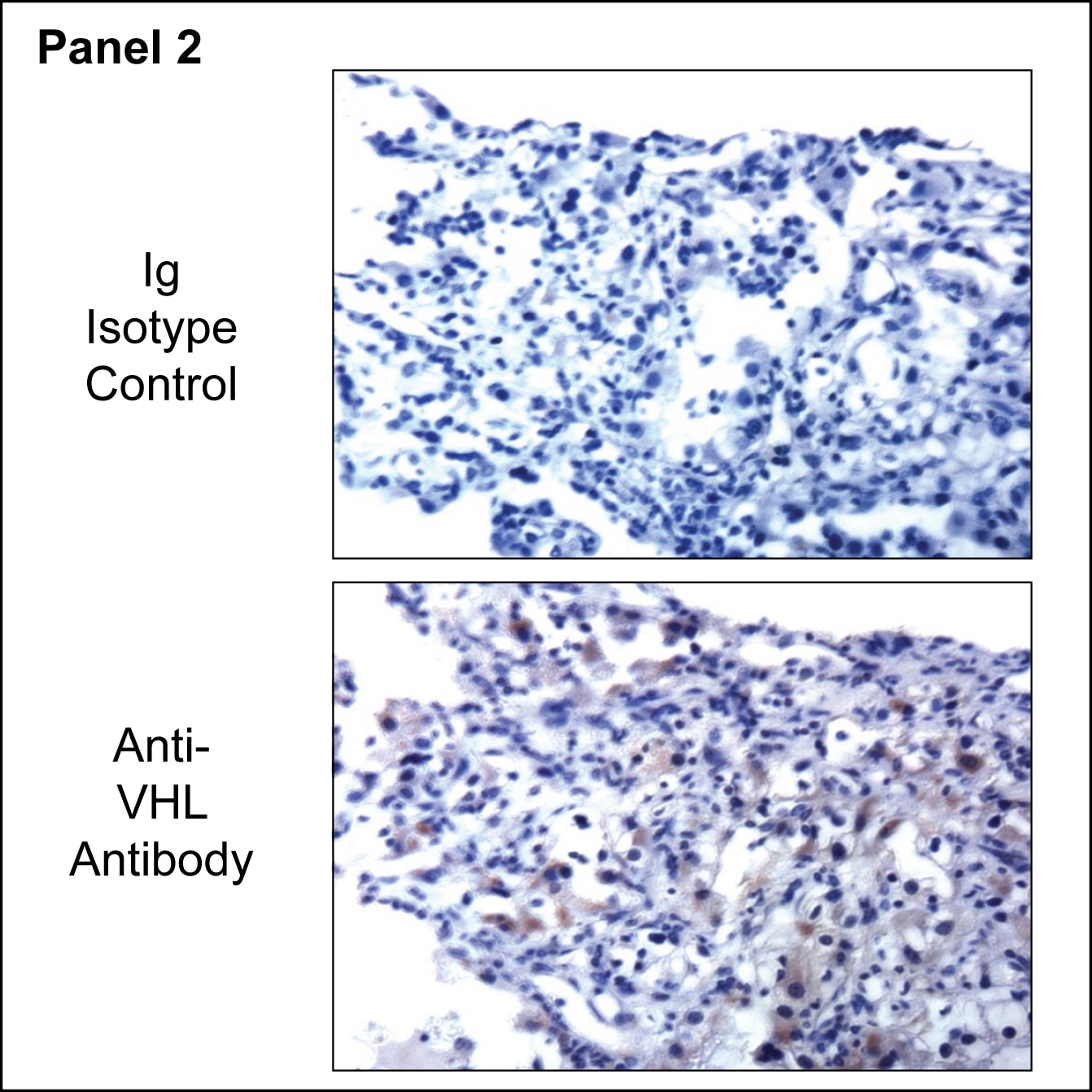 Purified Mouse Anti-Human VHL