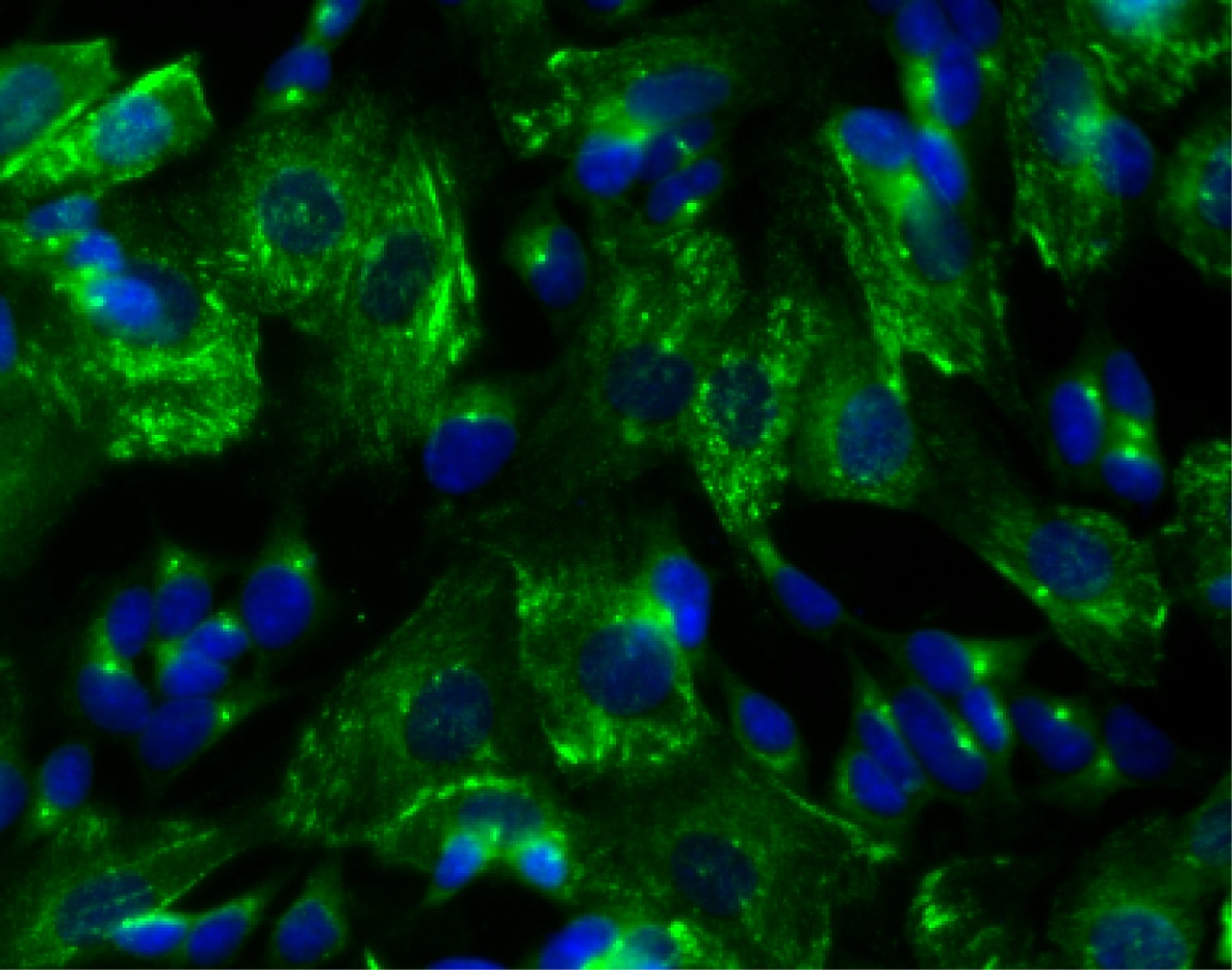 Purified Mouse Anti-PKA RIIβ (pS114)