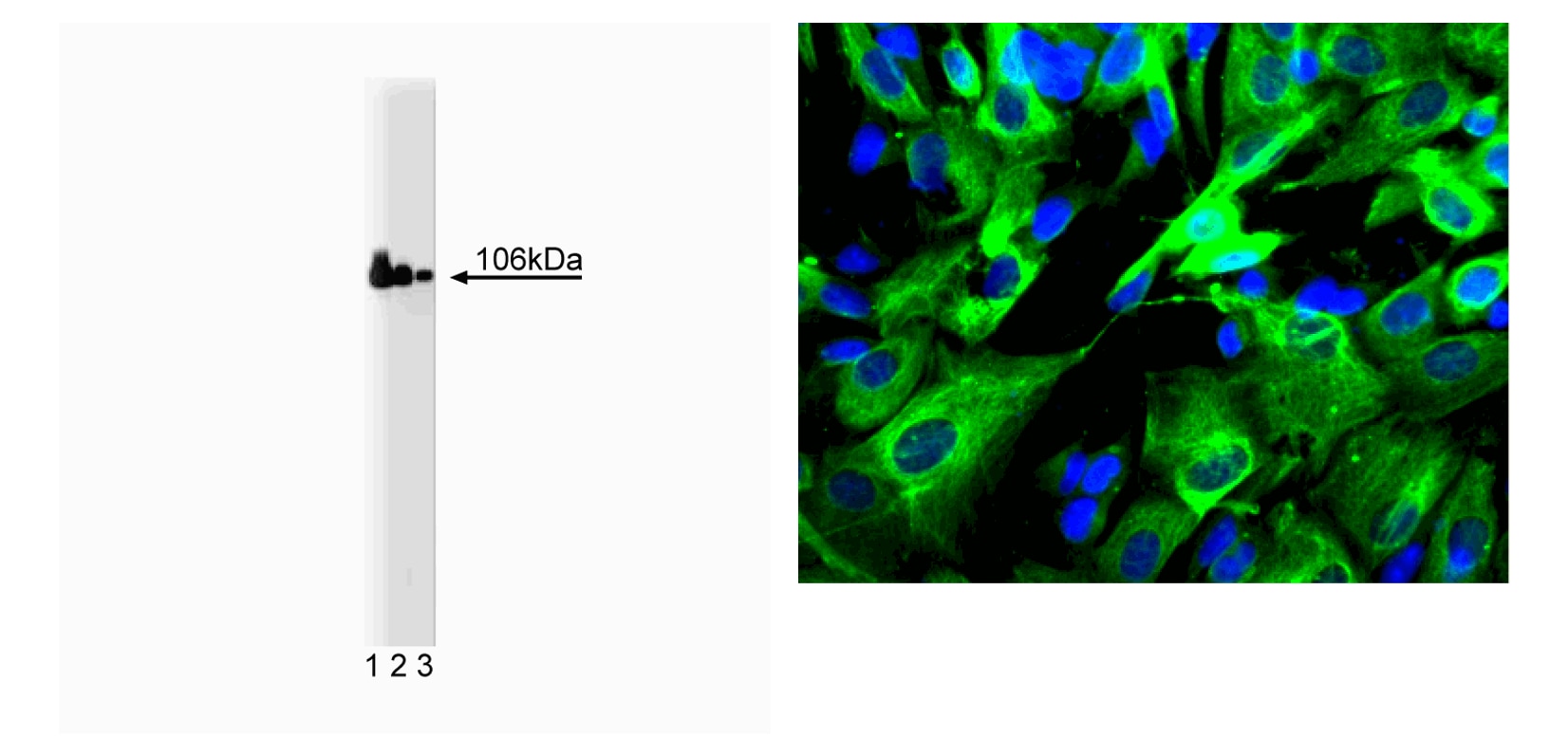 Purified Mouse Anti-Adaptin β