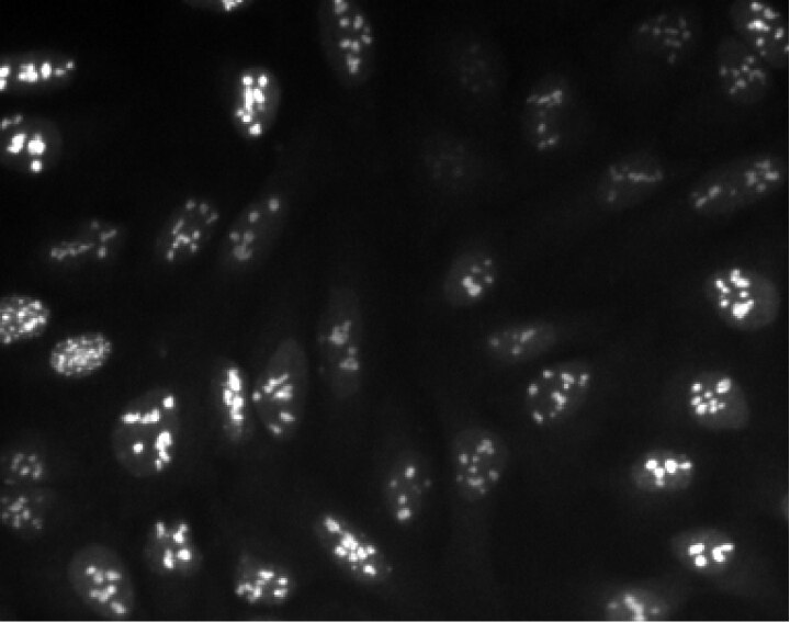 Purified Mouse Anti-Human Ki-67