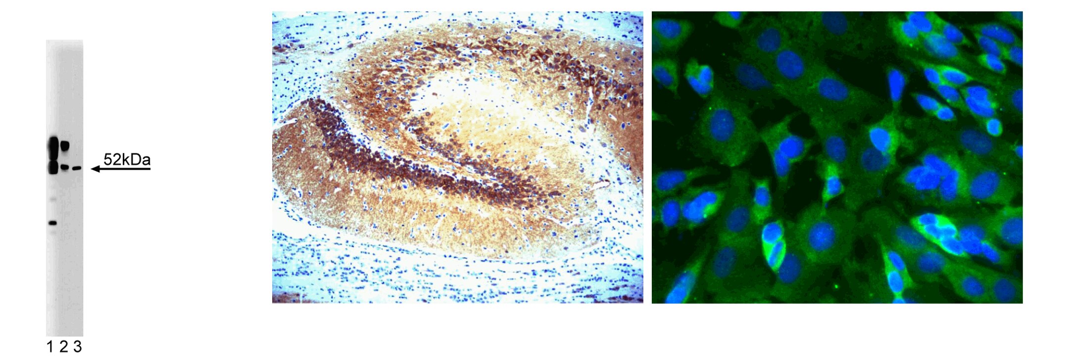 Purified Mouse Anti-CaM Kinase II